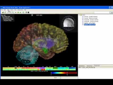 Tutorial: Brain Explorer® 3-D Viewer for the Allen Human Brain Atlas ...