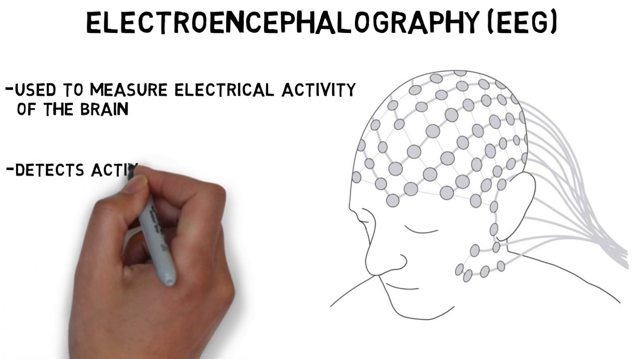 2-Minute Neuroscience: Electroencephalography (EEG) | Neutrify 2-Minute Neuroscience: Electroencephalography (EEG) | Neutrify
